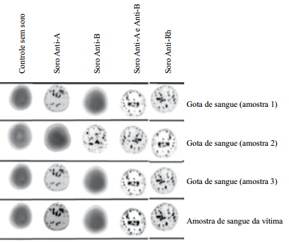 Questões de Biologia - Alelos múltiplos: grupos sanguíneos dos sistemas ABO, Rh e MN - 2014